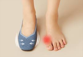 6 Rekomendasi Sepatu untuk Kaki Lebar, Dijamin Stylish! - Laruna